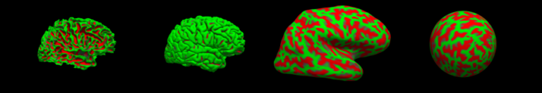 FreeSurfer – Laboratories for Computational Neuroimaging
